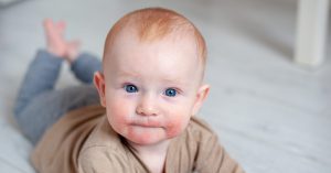 Teething Rash: What is it and How To Treat It - St. Johns Pediatric ...