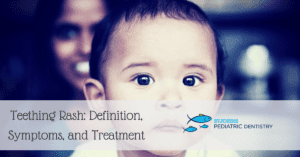 Teething Rash: What is it and How To Treat It - St. Johns Pediatric ...